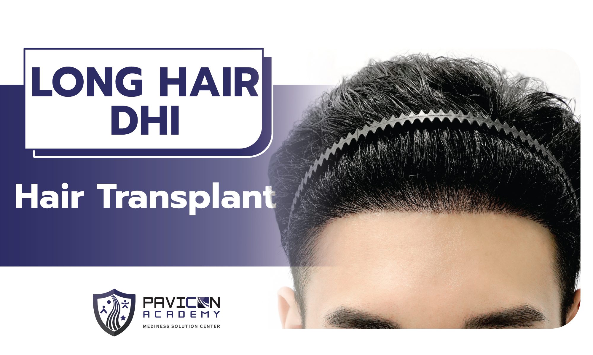 Long Hair DHI - Pavicon Mediness Center