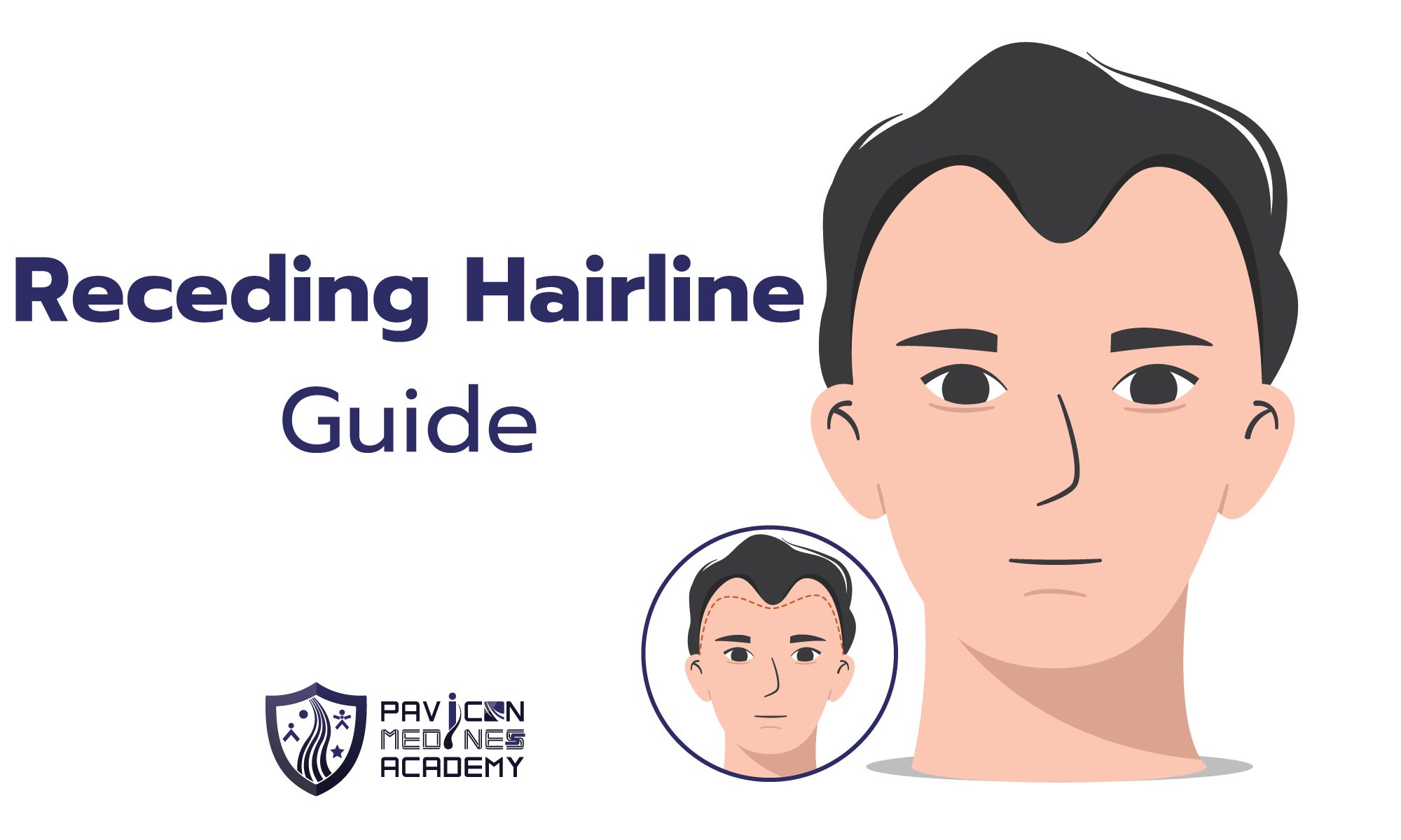 Hair Line Guide - Pavicon Mediness Center
