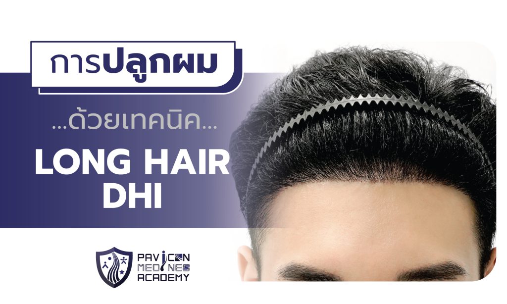 Long Hair DHI - Pavicon Mediness Center