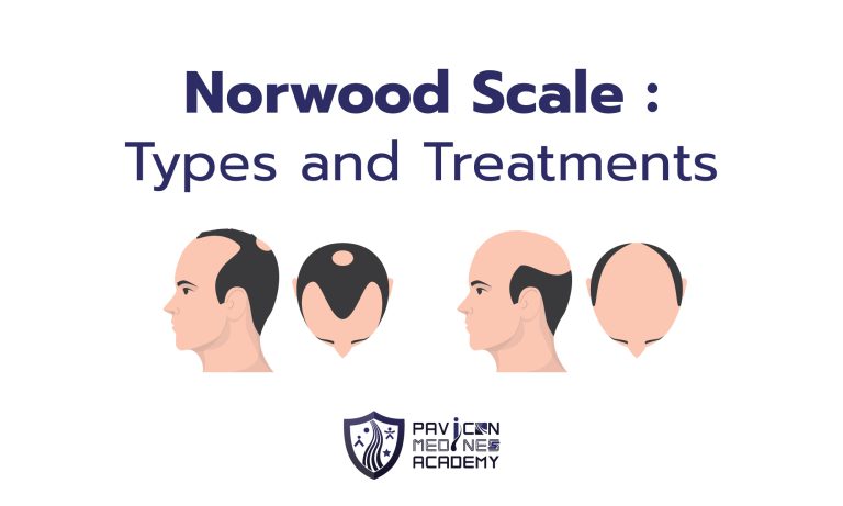 Norwood & Hamilton Scales - Pavicon Mediness Center