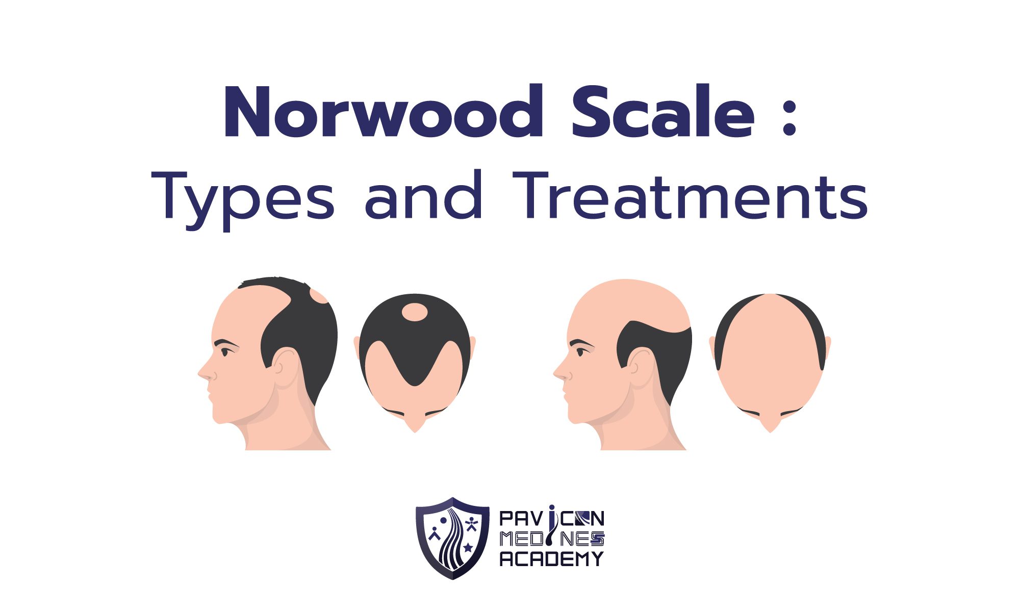 Norwood & Hamilton Scales - Pavicon Mediness Center