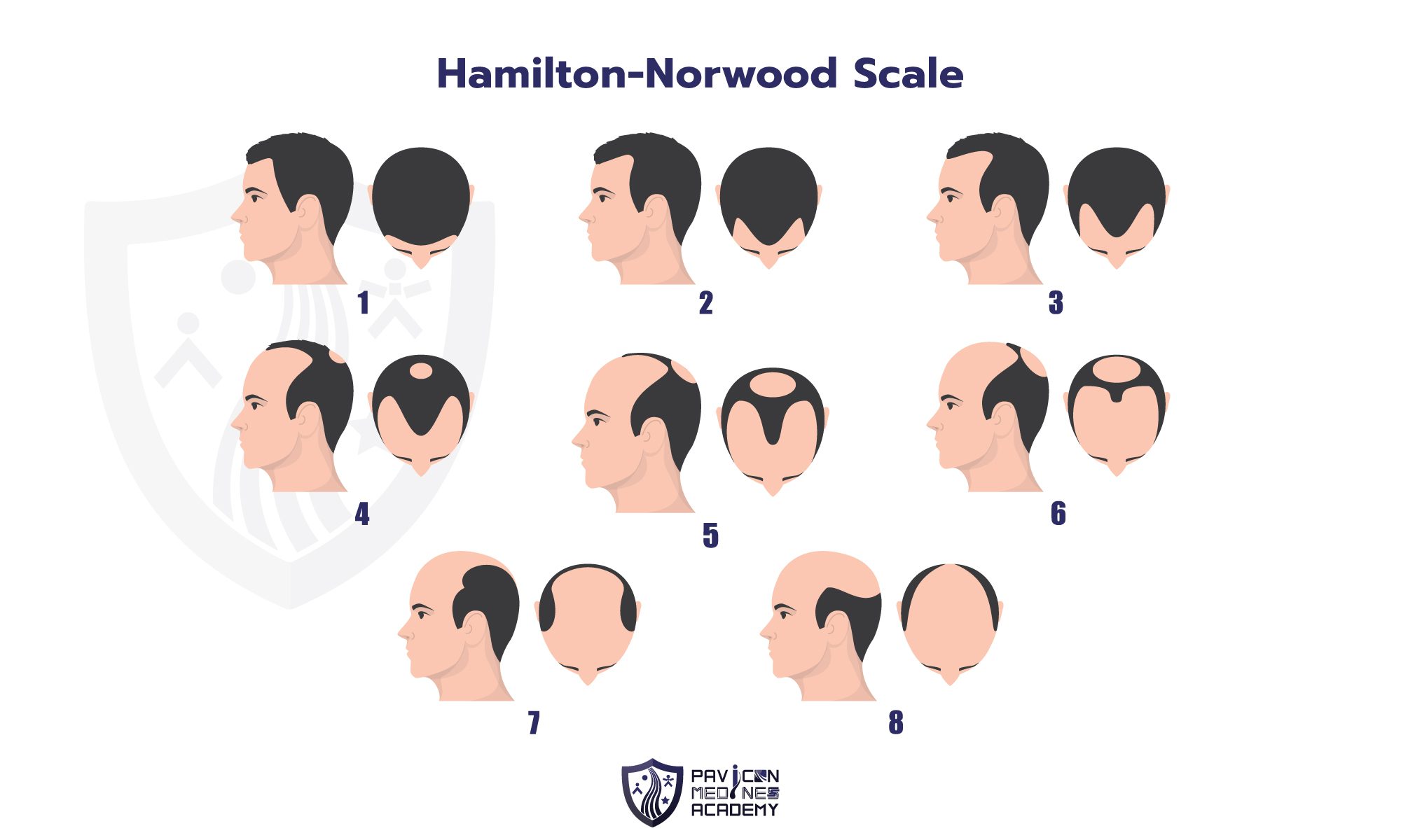 Hair Transplant Guide - Pavicon Mediness Center